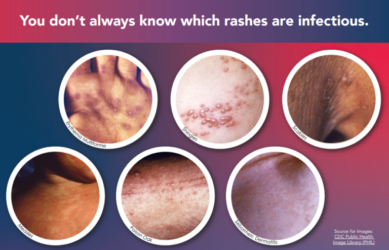 New Resource: CDC Project Firstline Infection Control Micro-Learns ...