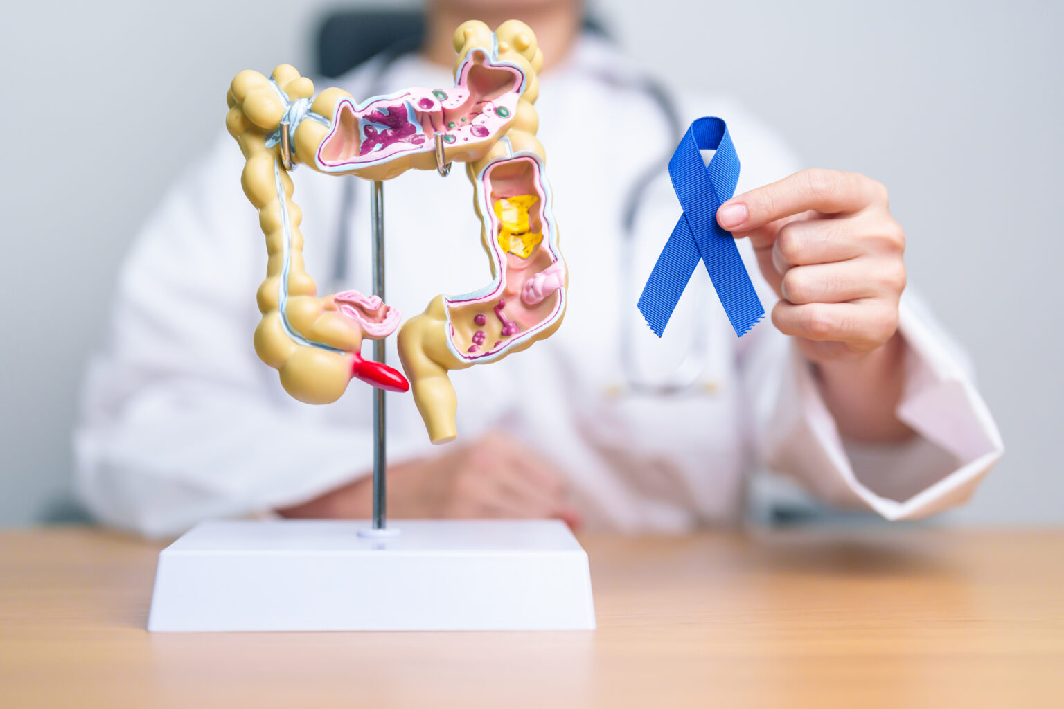8 Things You Should Know About Colorectal Cancer - Salud America